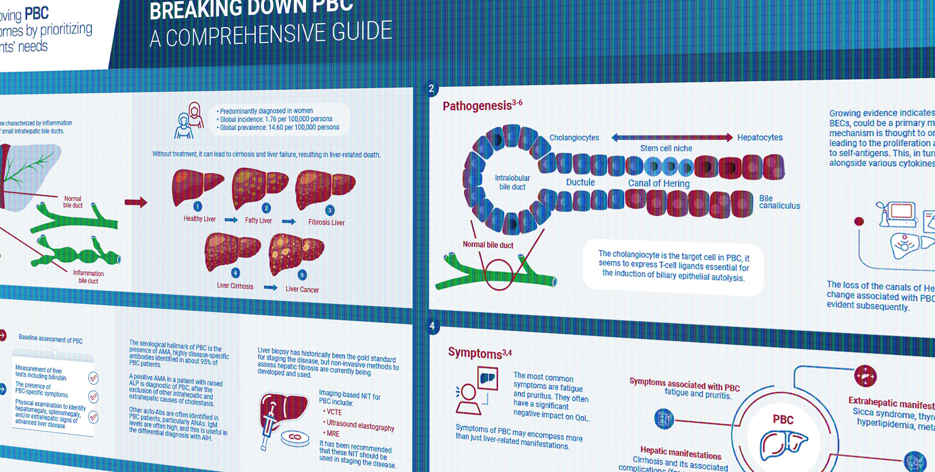 Breaking down PBC: a comprehensive guide - Cholestasis Unveiled ...